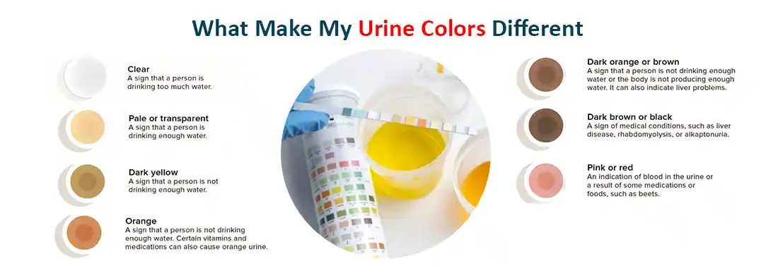 What Do Different Urine Colors Mean? Know Your Health Better | Ganesh ...