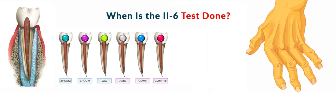 IL-6 Test: When is it Done, Low vs Normal vs High Range, Cost in India