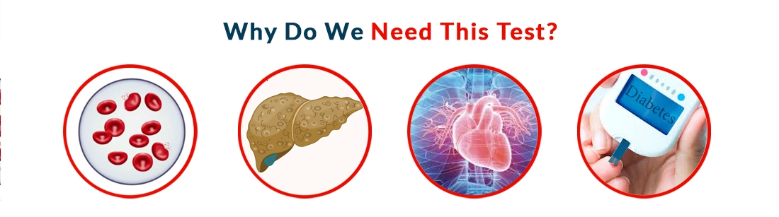 RDW (Red Cell Distribution Width) Test: Normal Range And Cost in Delhi