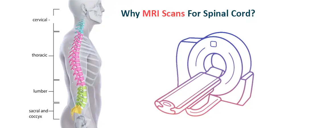 Decoding Spinal Cord MRI: A Patient Guide | Ganesh Diagnostic