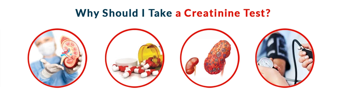 How to Lower Creatinine Levels | Ways to Keep Creatinine Level Normal?
