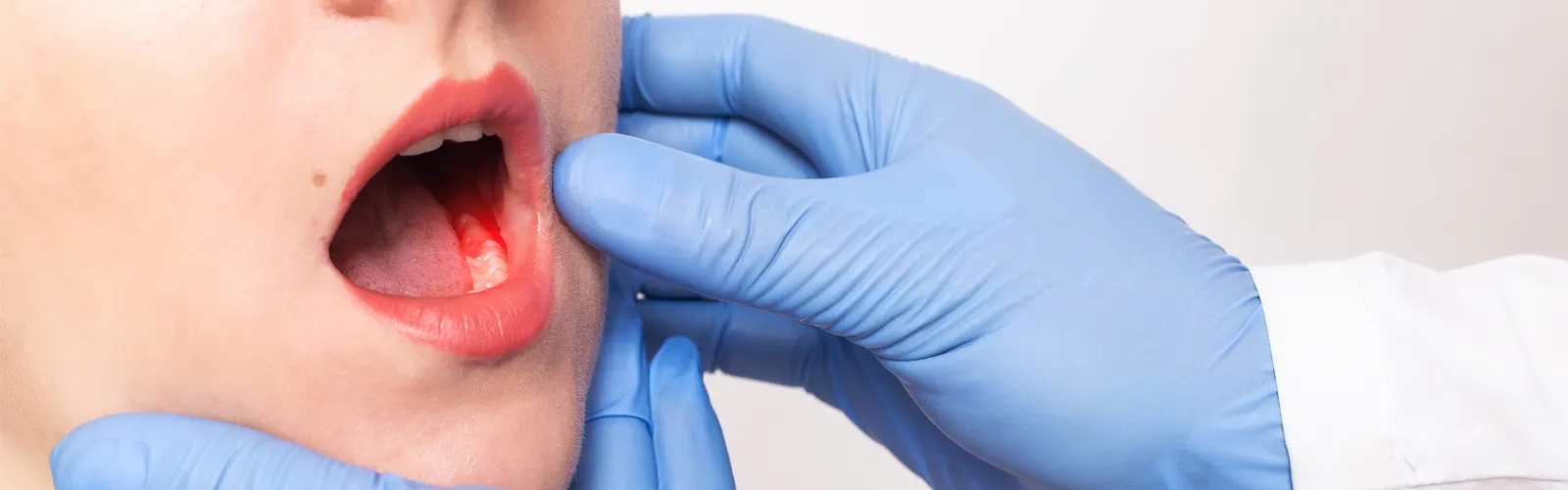 Mouth Cancer : Types, Stages, Symptoms, Causes, and Tests | Ganesh ...