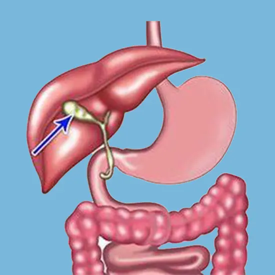 Gallbladder Cancer : Types, Stages, Symptoms, Causes and Tests | Ganesh ...