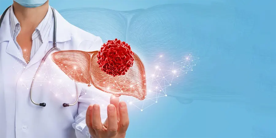 Liver Cancer : Types, Stages, Symptoms, Causes and Tests | Ganesh ...
