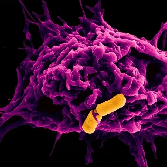 Food Poisoning - Symptoms, Types, Causes & Diagnosis