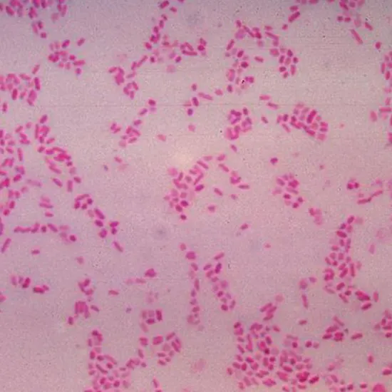 Bacteroides Species : In Relevance To Humans