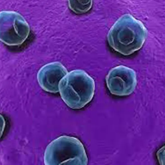 Protect Your Lungs From Chlamydia Pneumoniae : Prevention is Key ...