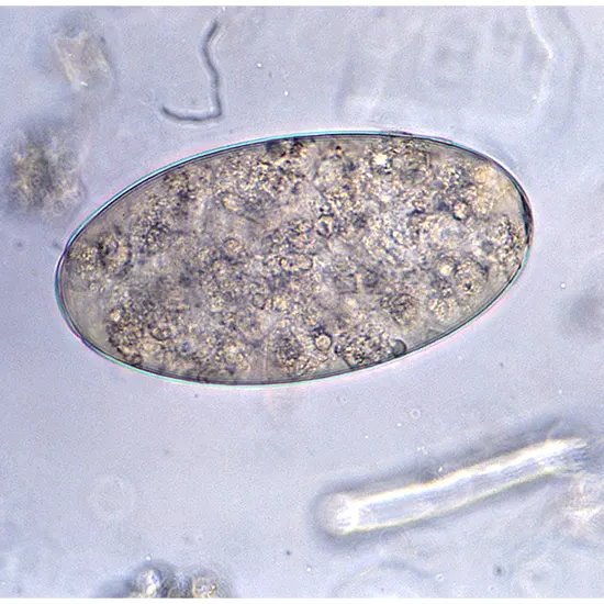 The Fascinating World Of Fasciolopsis Buski : Symptoms, Prevention and ...