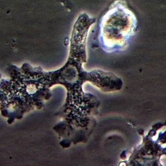 A Comprehensive Guide To Free Living Amoebic Infections | Ganesh Diagnostic