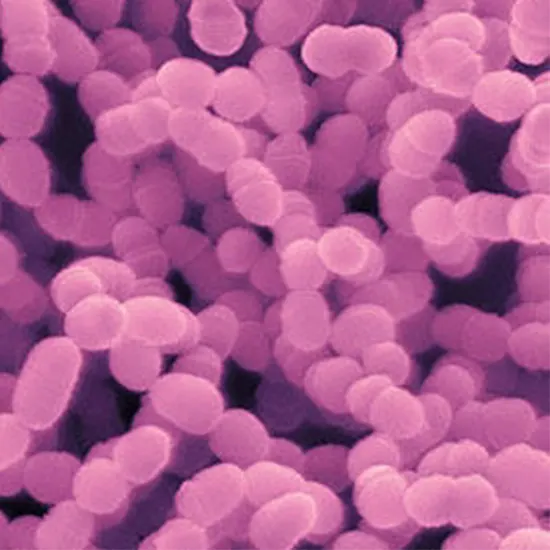 Streptococcus Mutans : The Sneaky Dental Saboteur | Ganesh Diagnostic