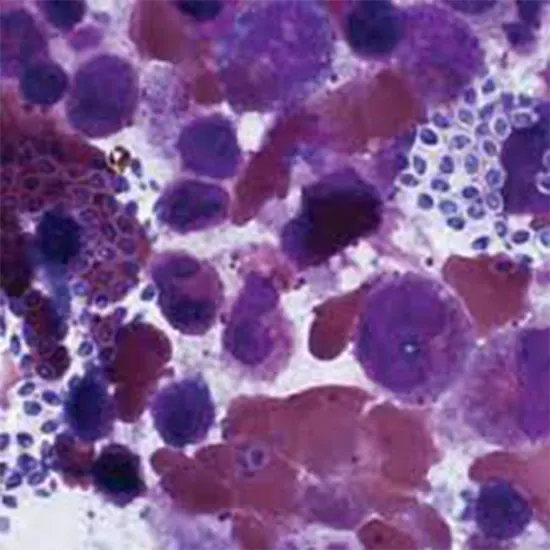 Tiny Parasites, Big Impact : The Microsporidia Phylum | Ganesh Diagnostic