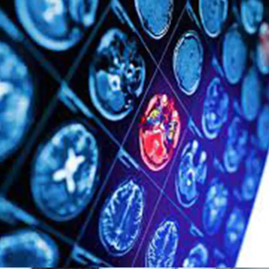 What Are The Indications Of CT Scan? | Ganesh Diagnostic