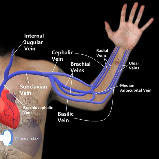 What are the Indications of Color Doppler of Upper Limbs