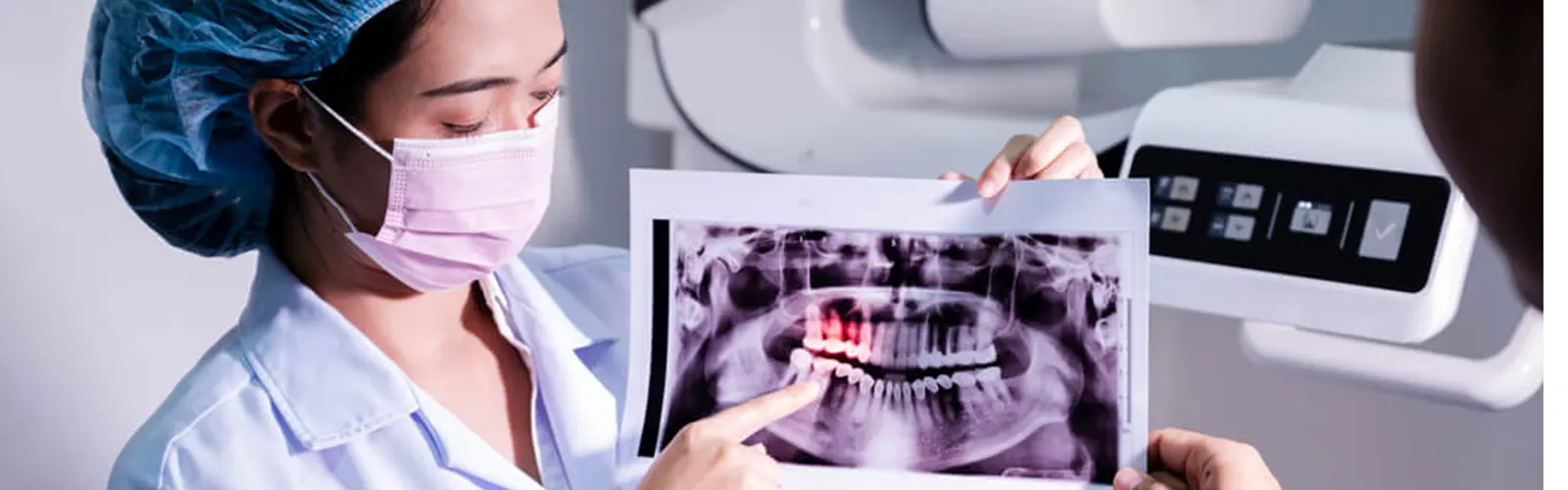 What Does the Report of the OPG Test Show?