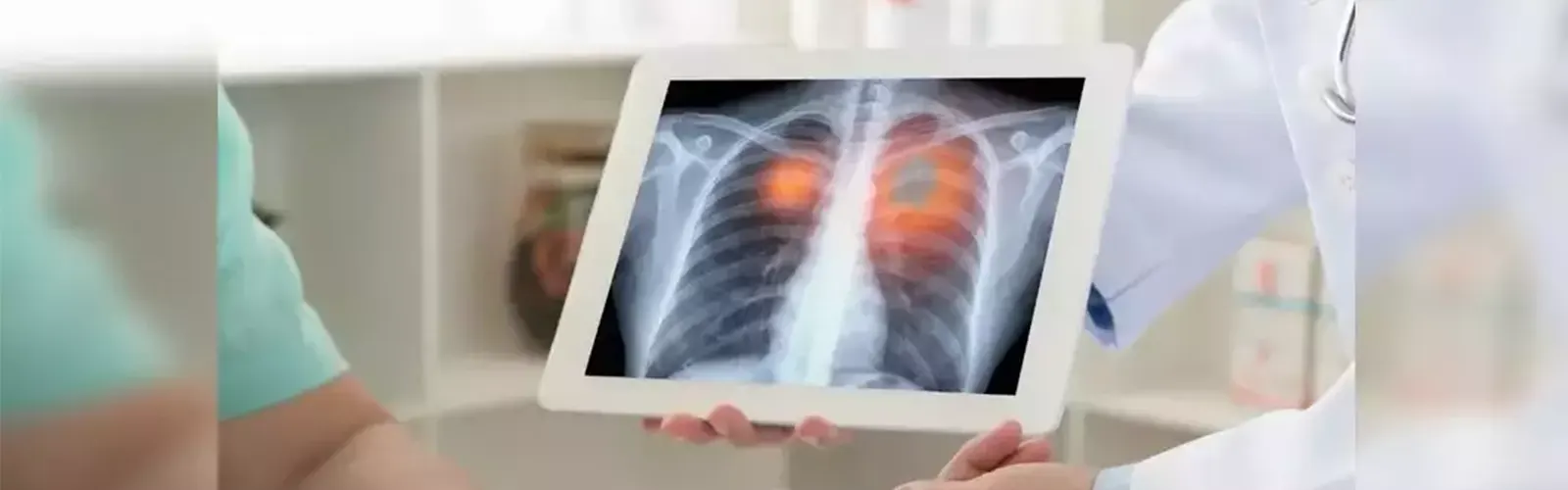 How Long Does It Take to Prepare HRCT Chest Scan Report?