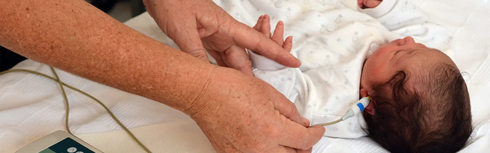 What Are The Limitations Of Bera Test? | Ganesh Diagnostic