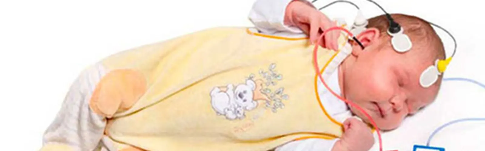 What Are The Indications Of Bera Test? | Ganesh Diagnostic