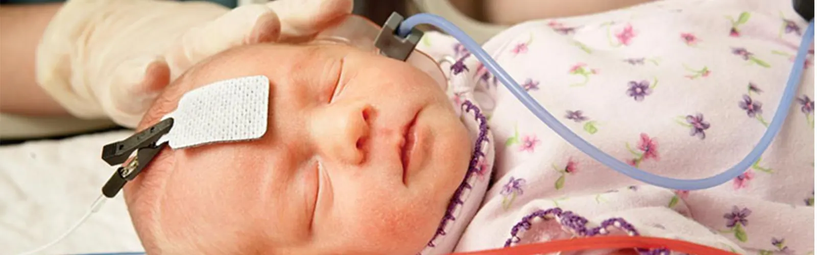 How Much Time Does It Take To Prepare Bera Report? | Ganesh Diagnostic