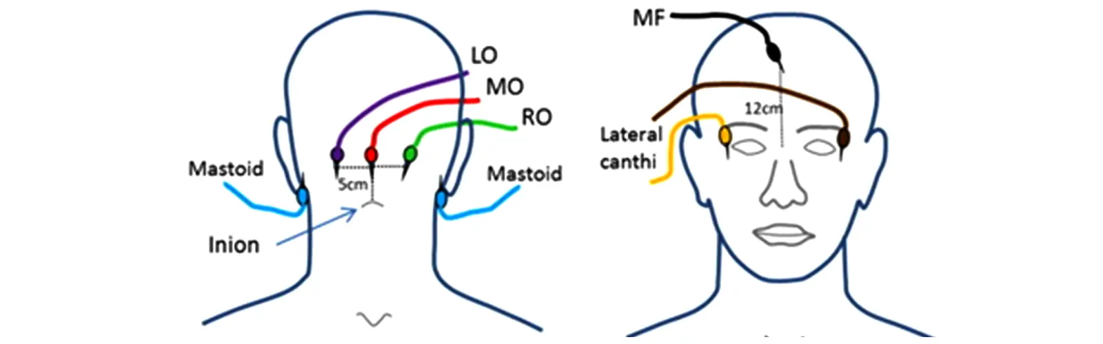 Why Is Visual Evoked Potential (VEP) Test Done? | Ganesh Diagnostic