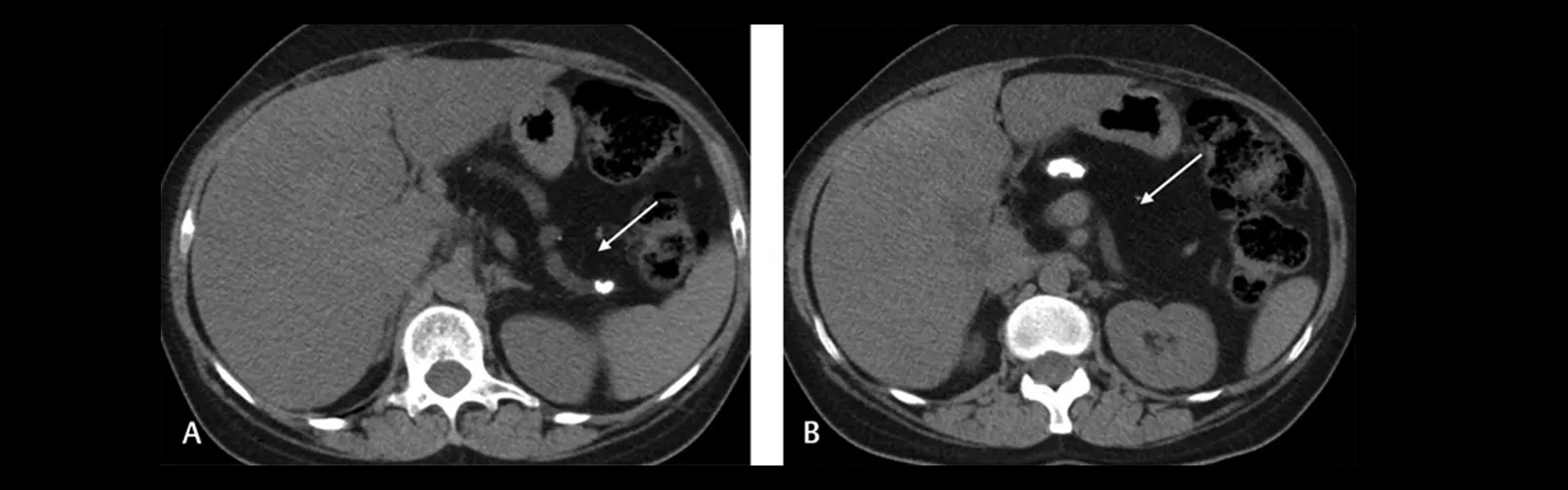 What Are The Advantages Of NABH Authorized Center For NCCT Whole ...