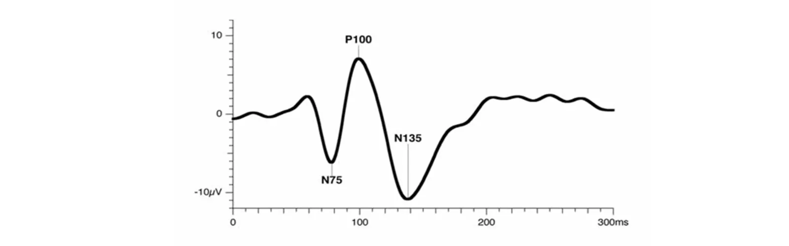 What Does Visual Evoked Potential (VEP) Test Detect? | Ganesh Diagnostic