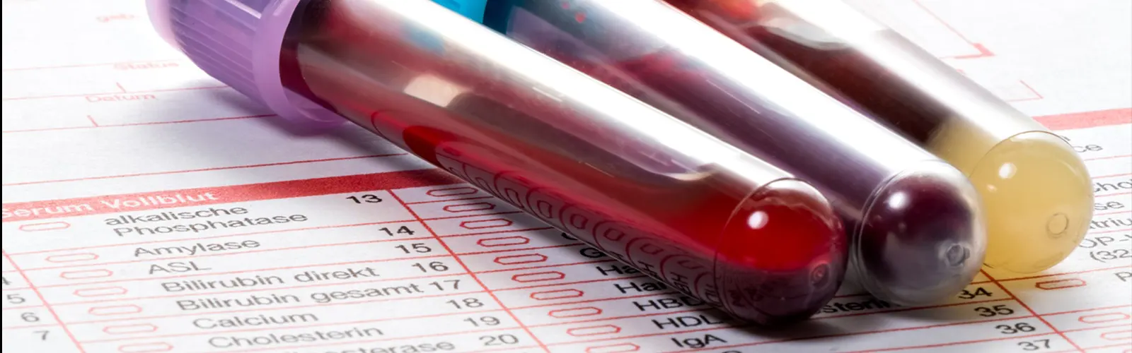 Top 10 Benefits of Routine Blood Work