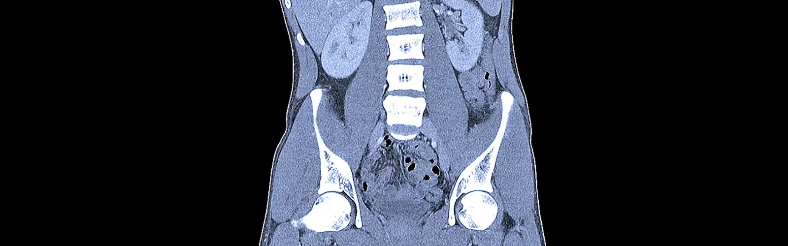 Which Medication Is Injected For CECT Whole Abdomen? | Ganesh Diagnostic