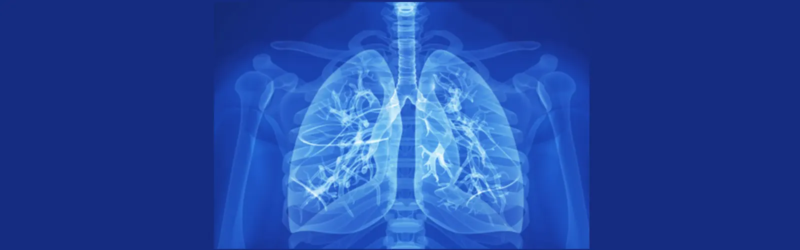 What Is The Role Of CT Chest 3D In Respiratory Health? | Ganesh Diagnostic