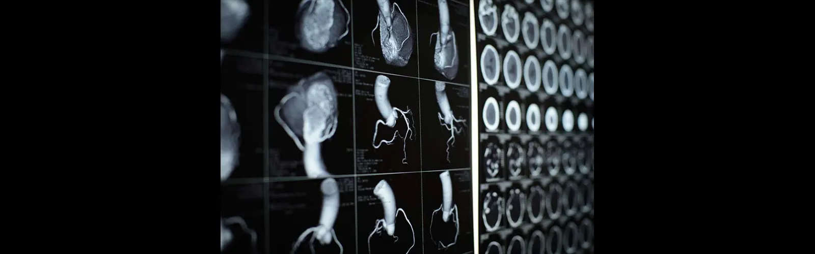 How Is CT Chest 3D Useful For Lung Disease? | Ganesh Diagnostic