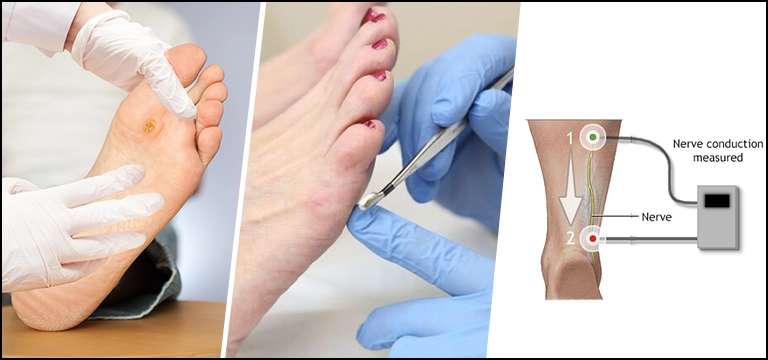 A Comprehensive Guide to NCV Test