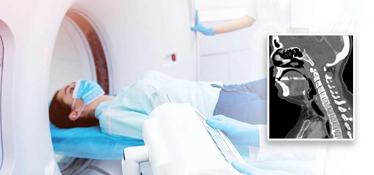 CT Neck scan : Procedure, Uses, Results, Risks, Side Effects and Cost ...