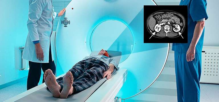 CT KUB Scan : Procedure, Uses, Results, Risks and Side Effects | Ganesh ...