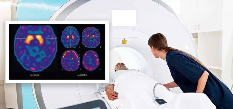 A Comprehensive Guide to Trodat Scan and its Procedure
