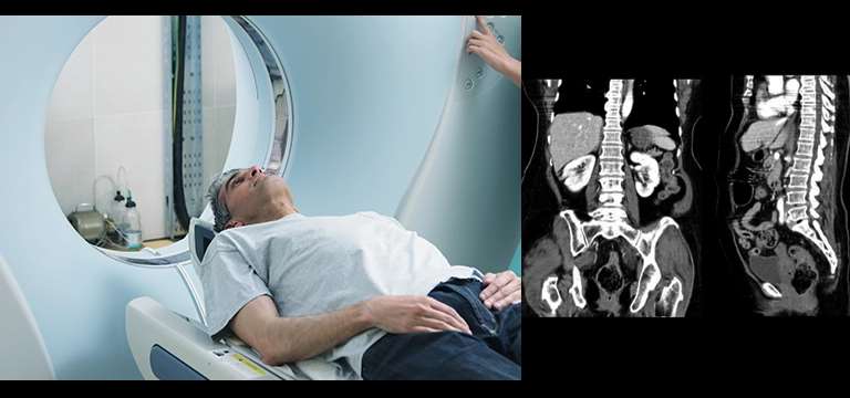 Pelvis CT Scan : Purpose, Procedure, Cost, Risks and Side Effects ...