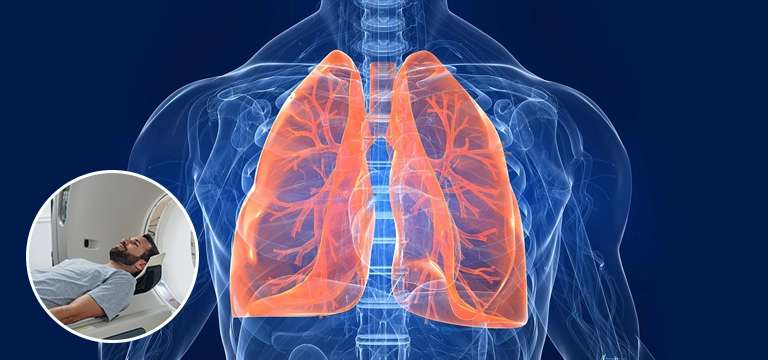 A Detailed Guide to Lung Ventilation Scan