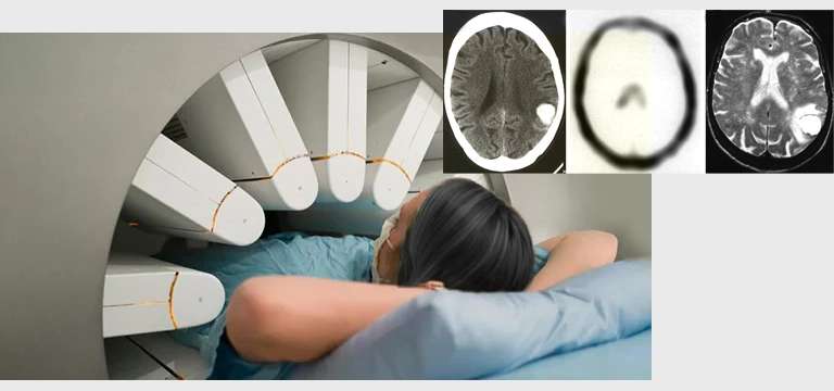 A Detailed Guide to MIBI Brain SPECT