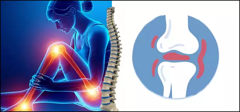 Understanding the Arthritis Profile Test : Diagnosis, Conditions, and ...