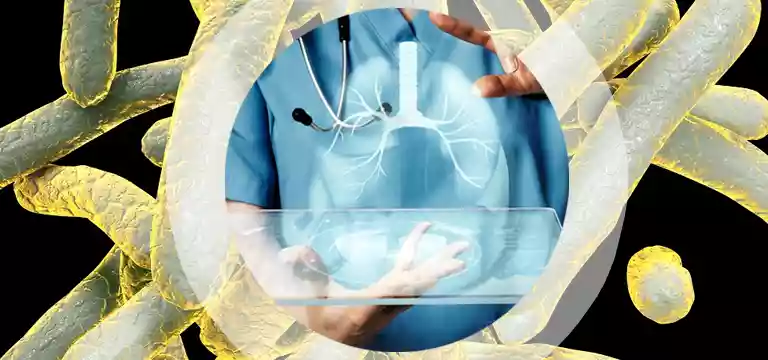 Extra Pulmonary Tuberculosis: Understanding, Diagnosis, and Treatment