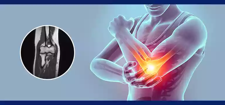 MRI of the elbow: Things you must know