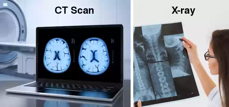 CT Scan vs. X-ray: A Comparative Analysis - Which Imaging Technique is ...