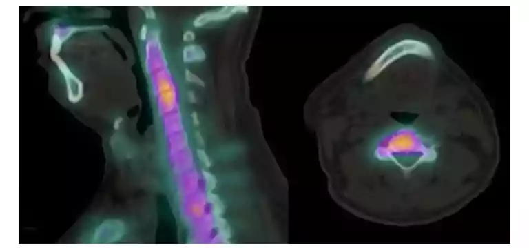 Role of CT Scans in Preoperative Planning: Enhancing Surgical Precision