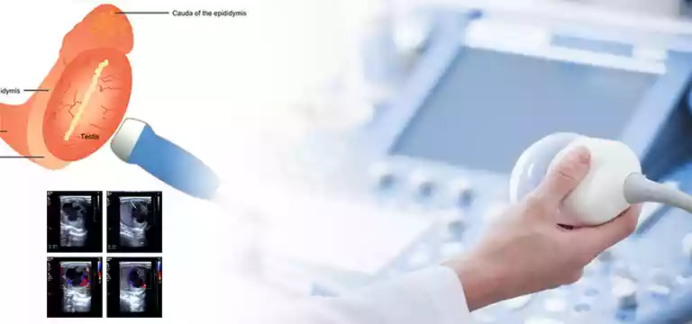 Scrotal Doppler Scan: Uses, Preparation, Procedure | Ganesh Diagnostic