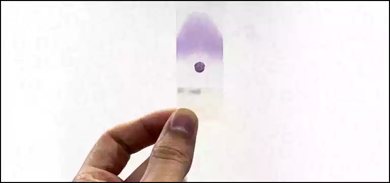 DLC Test: Know what the Normal Range of DLC is