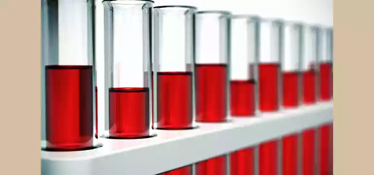 A Guide to SHBG (Sex hormone Binding Globulin) Test with Price