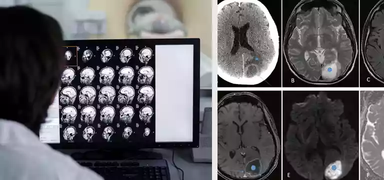 Comprehensive Guide to CT Scans for Neurological Disorders | Ganesh ...
