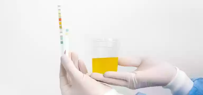 Urine Test: Purpose, Procedure & Cost
