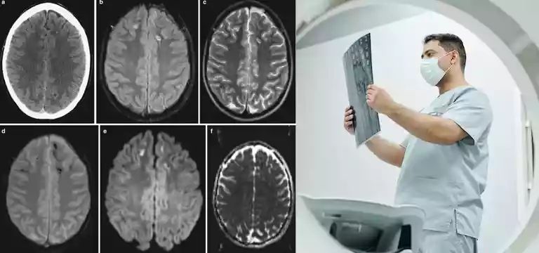 The Role of CT Scans in Assessing Traumatic Injuries | Ganesh Diagnostics