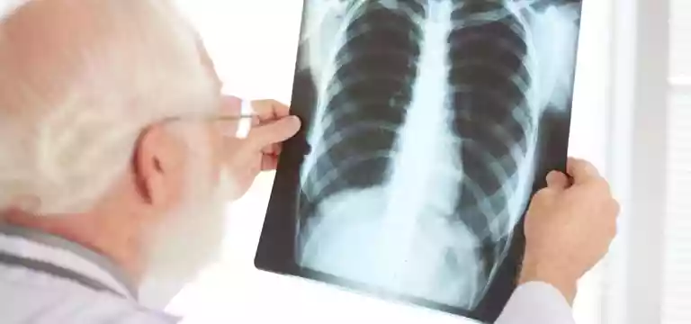 ABPA Panel Test: A comprehensive guide to causes, diagnosis, and treatment