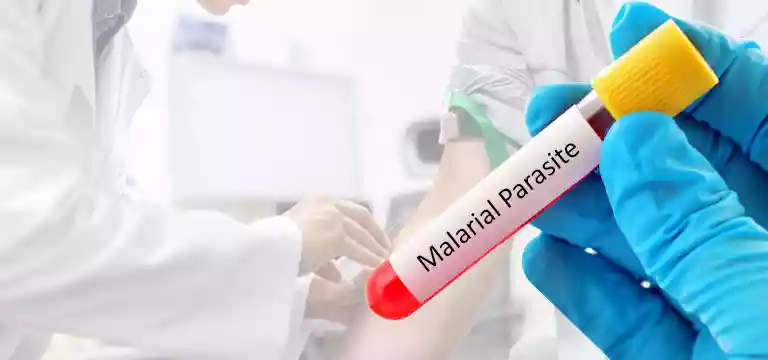 Malarial parasite (MP) Blood test: Test Purpose, Preparation, Procedure ...