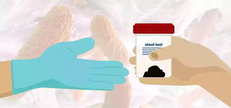 Stool Routine Examination: Purpose, Parameters, Procedure and more